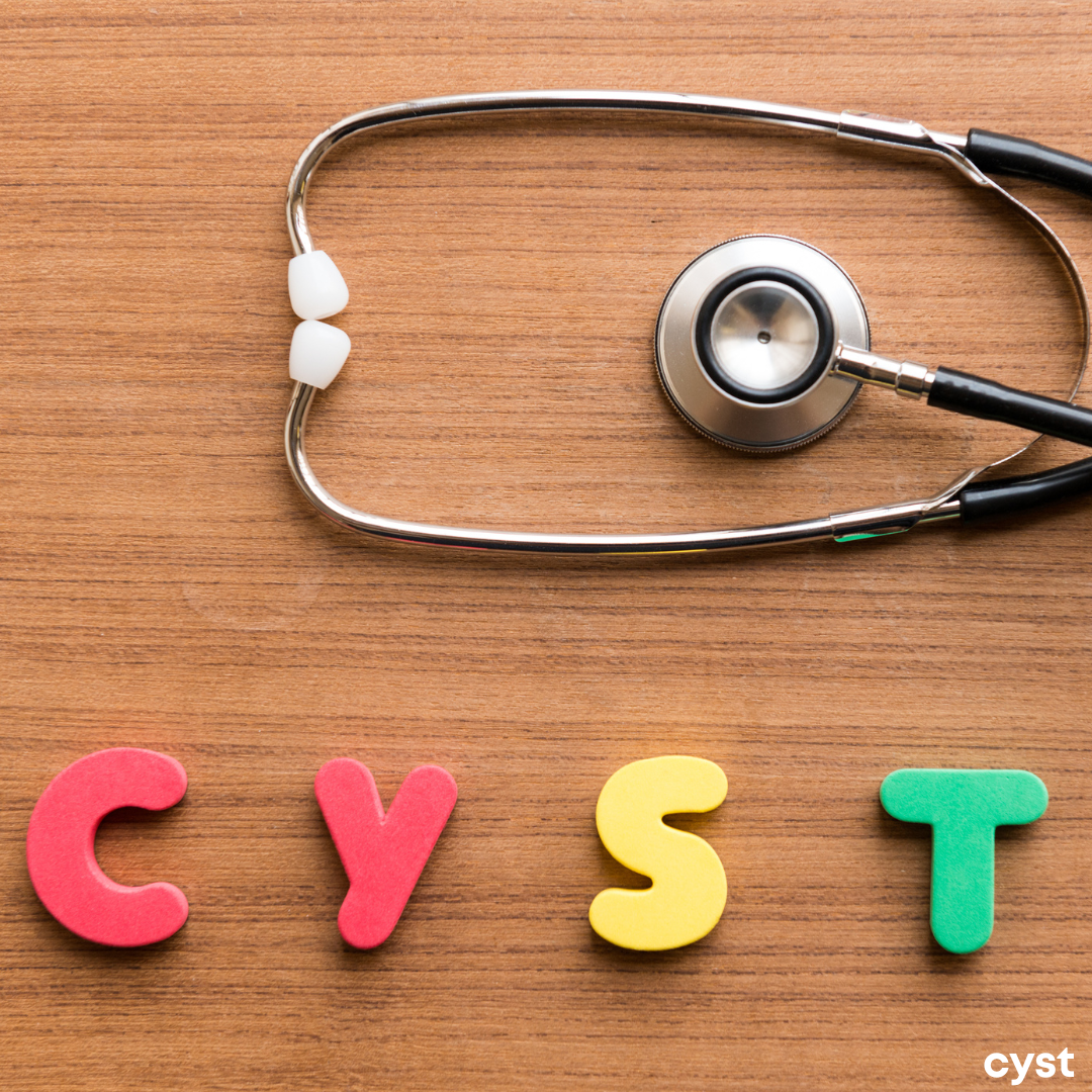 Surgery for sebaceous cyst removal: everything you need to know - Oxona ...