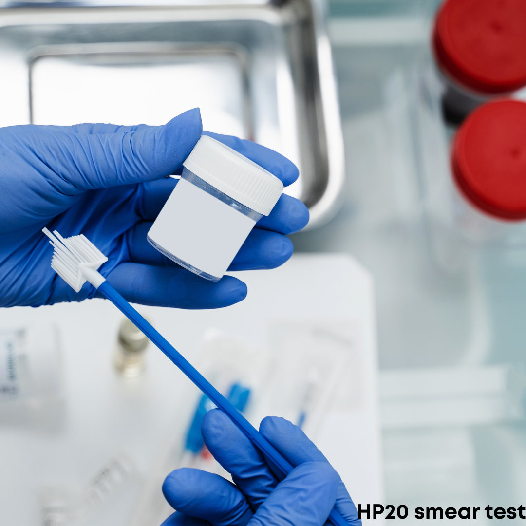 All you need to know about the HP20 smear test