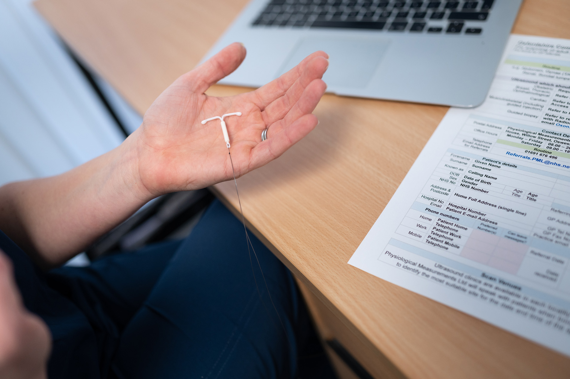 Coil fitting FAQ: Your comprehensive guide to common questions - Oxona ...